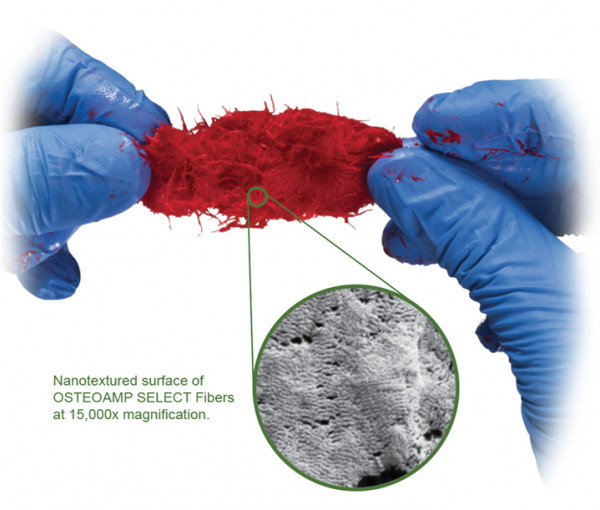 OSTEOAMP SELECT - Bioventus Surgical