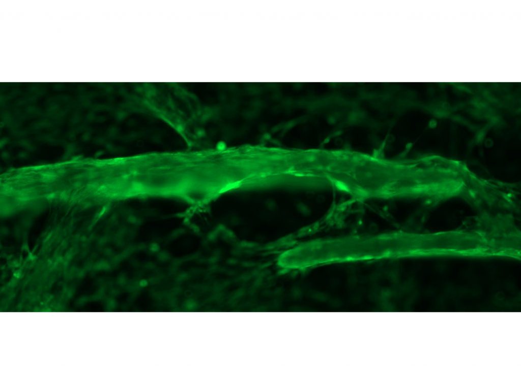 OSTEOAMP SELECT - Bioventus Surgical